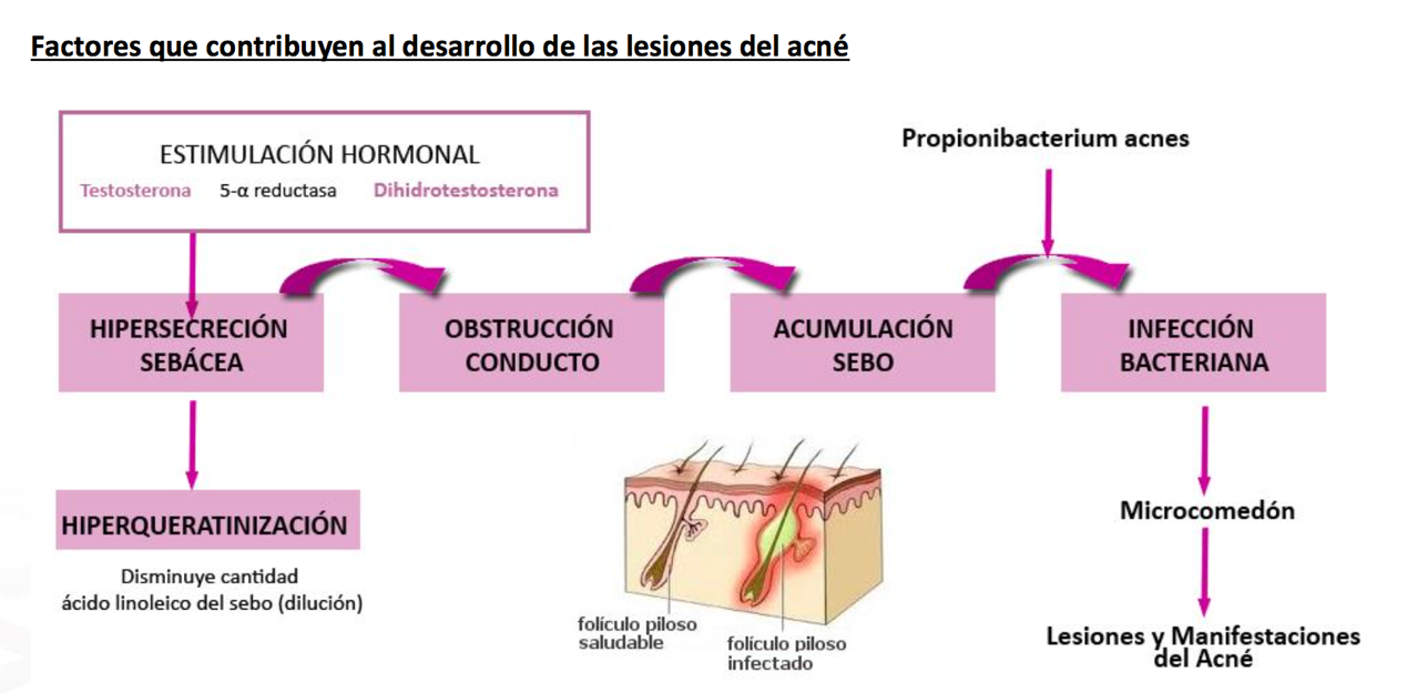 ACNÉ JUVENIL: «UNA ENFERMEDAD “FISIOLÓGICA» (Dentro de la “normalidad ...